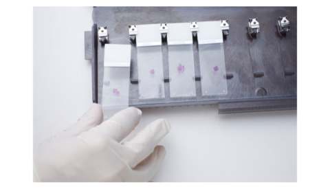 How Analyzing Histology Samples Leads to Diagnosis and Disease ...