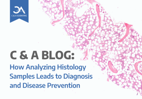 How Analyzing Histology Samples Leads to Diagnosis and Disease ...