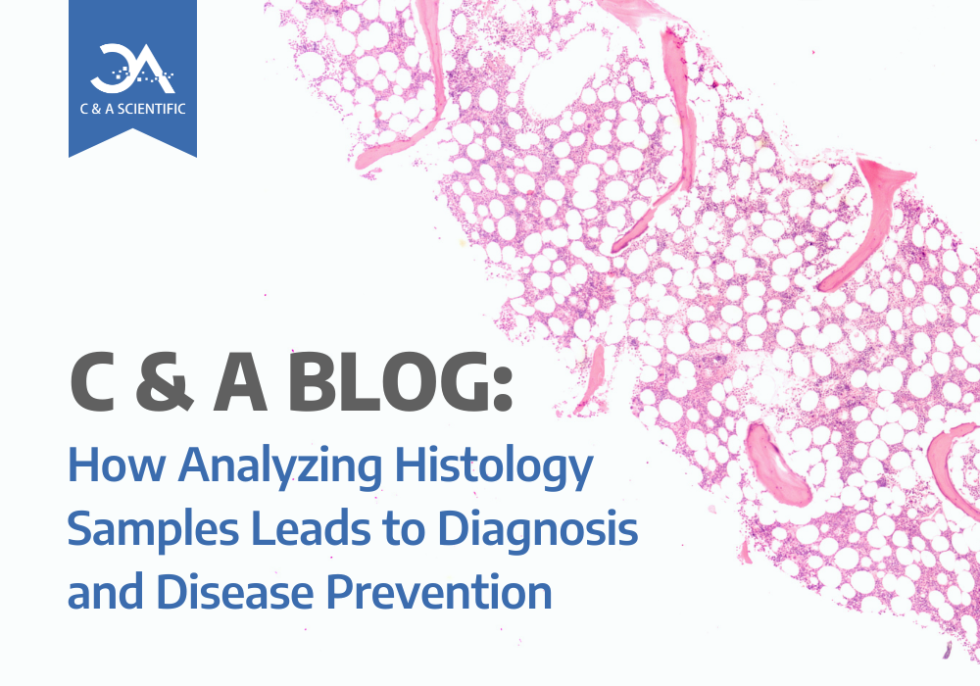 How Analyzing Histology Samples Leads to Diagnosis and Disease ...